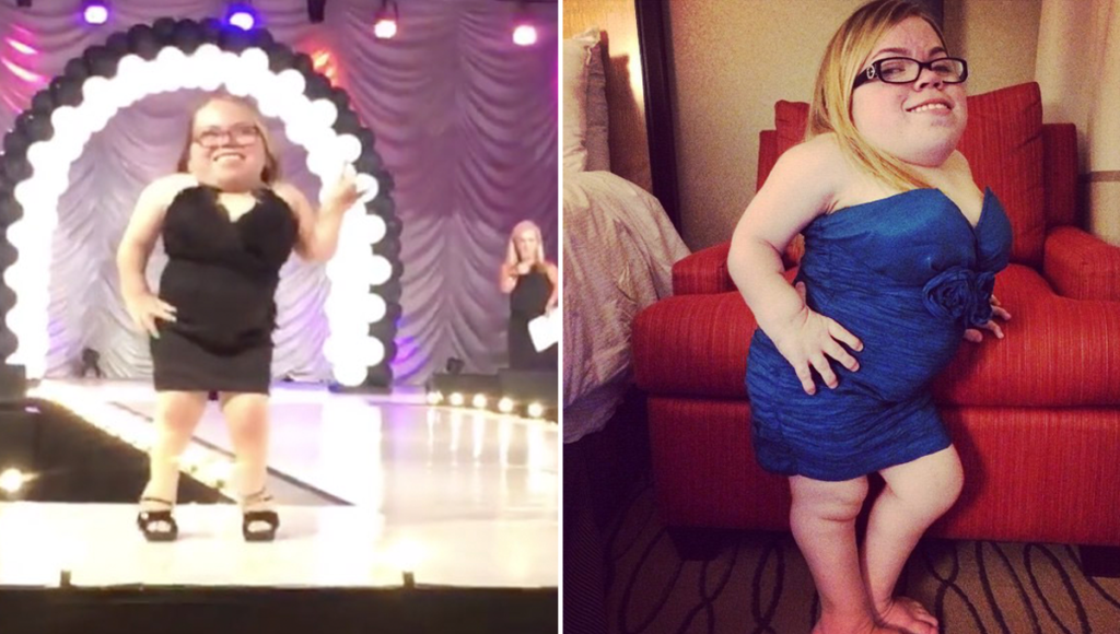 Woman with rare form of dwarfism called 'ugly midget' by cruel bullies ...