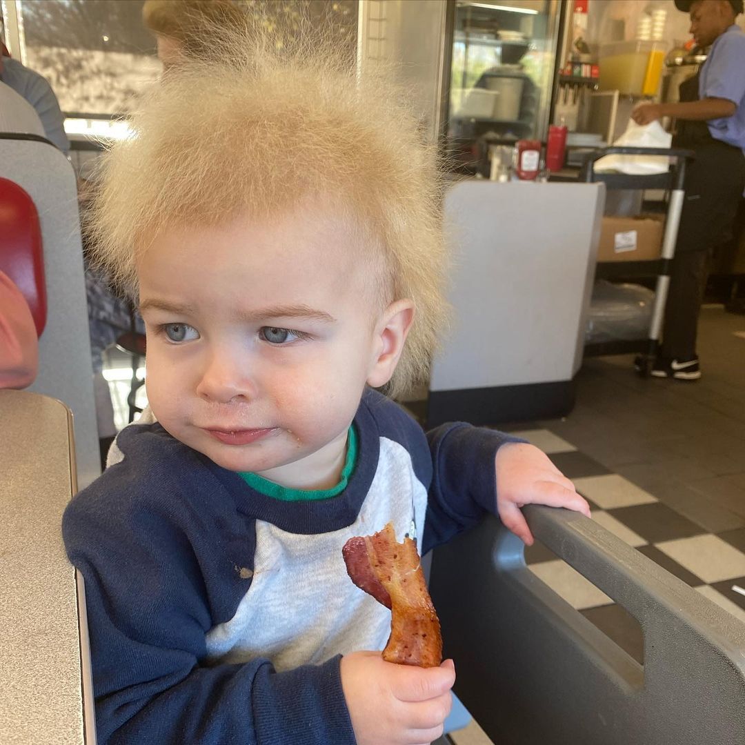 Mum of one-year-old with rare ‘uncombable hair syndrome’ says strangers ...