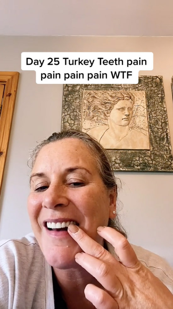 Woman left in 'excruciating pain' after getting expensive Turkey teeth ...