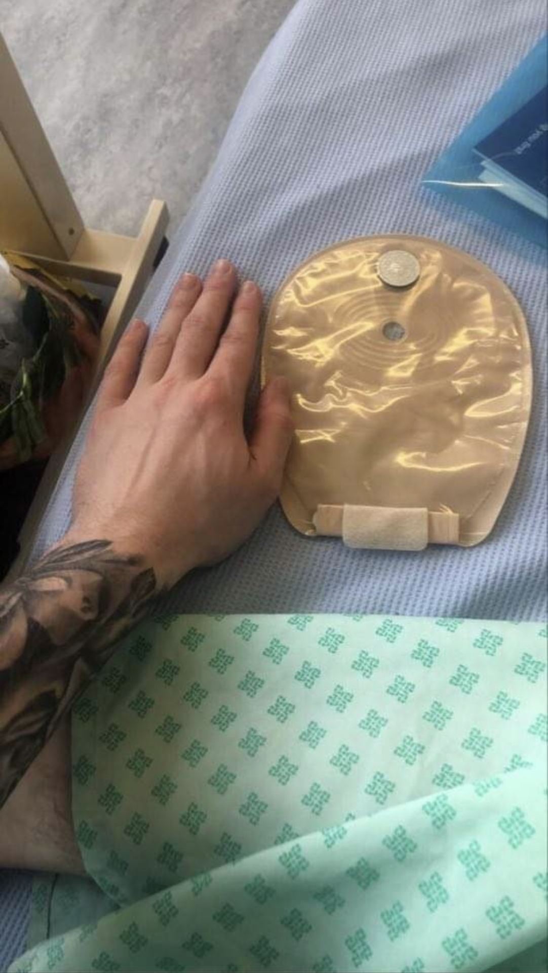 Man Goes Viral Revealing How He Has Sex With Colostomy Bag To Tackle Stigma Whats The Jam