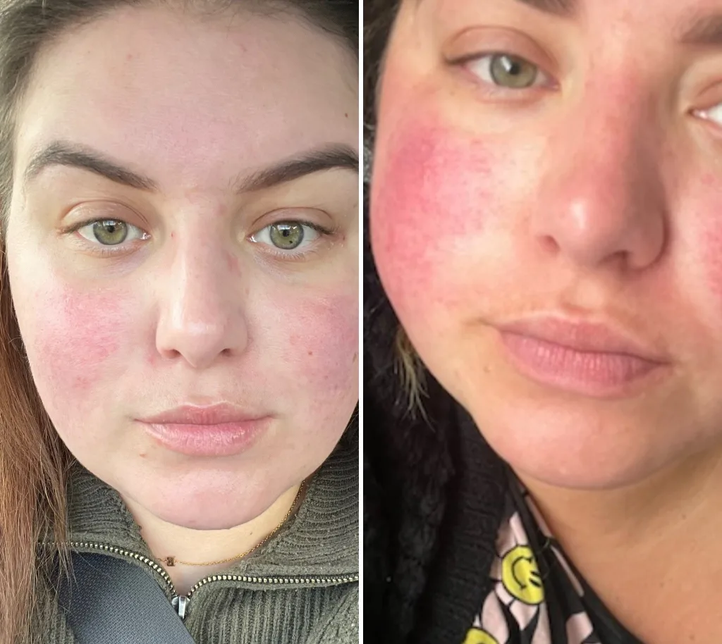 ‘I have the same condition as Amy Schumer – doctors told me to just ...