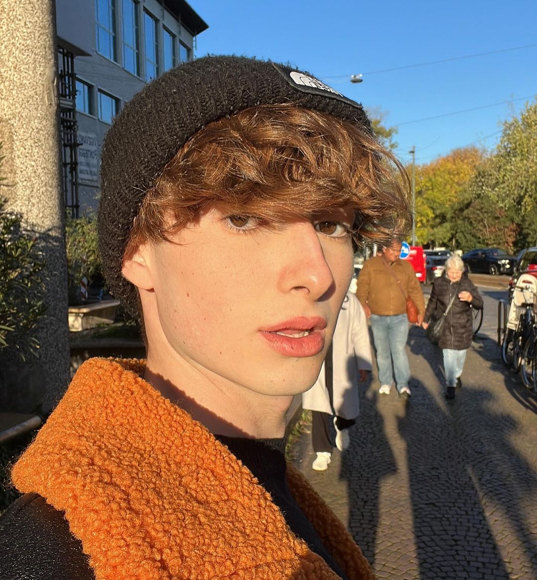 Male model dies aged 20 from rare bone cancer | Need To Know