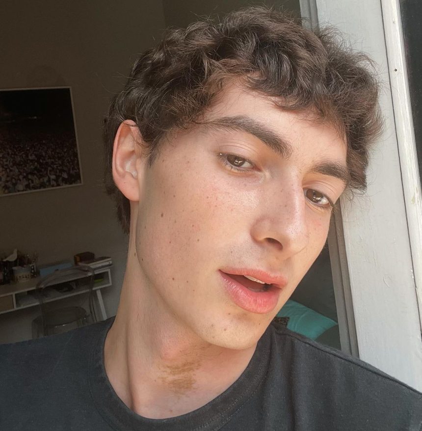 Male model dies aged 20 from rare bone cancer | Need To Know