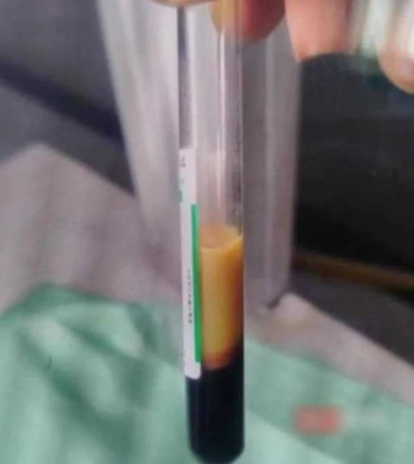 Medics drawing blood from patient with 'relatively good' weight stunned ...