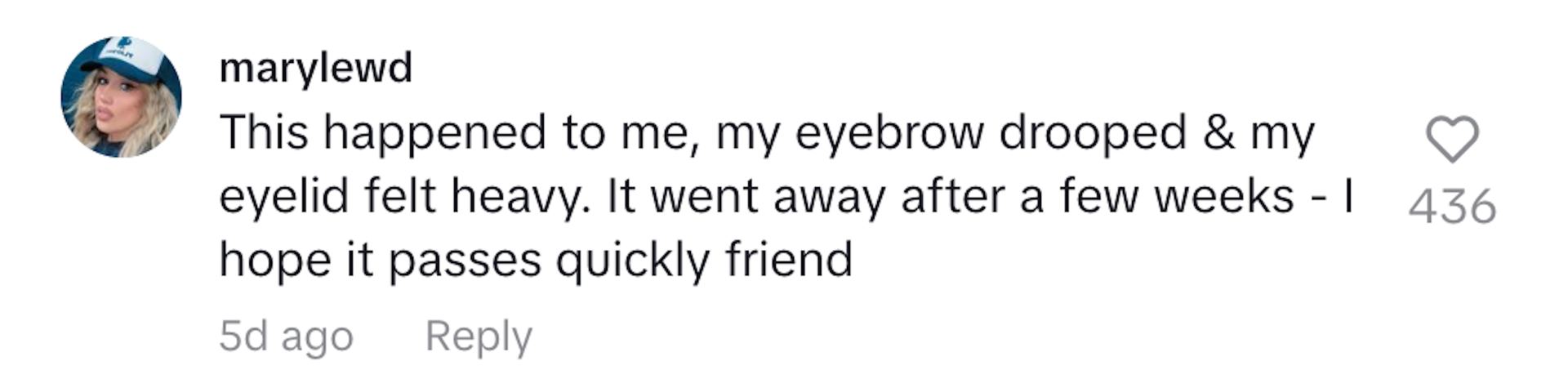 Woman left with lopsided ‘Frankenstein brow’ after 'Botox fail' | Need ...