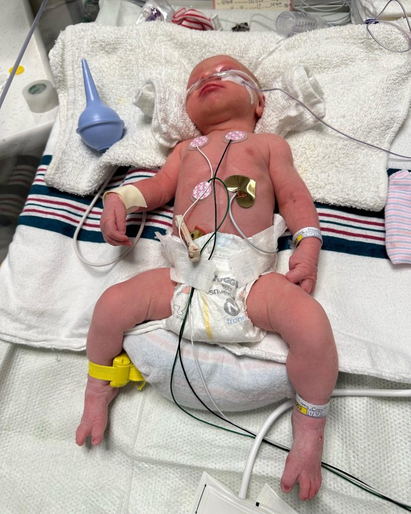 Baby born with super rare condition that only 400 people in world have ...