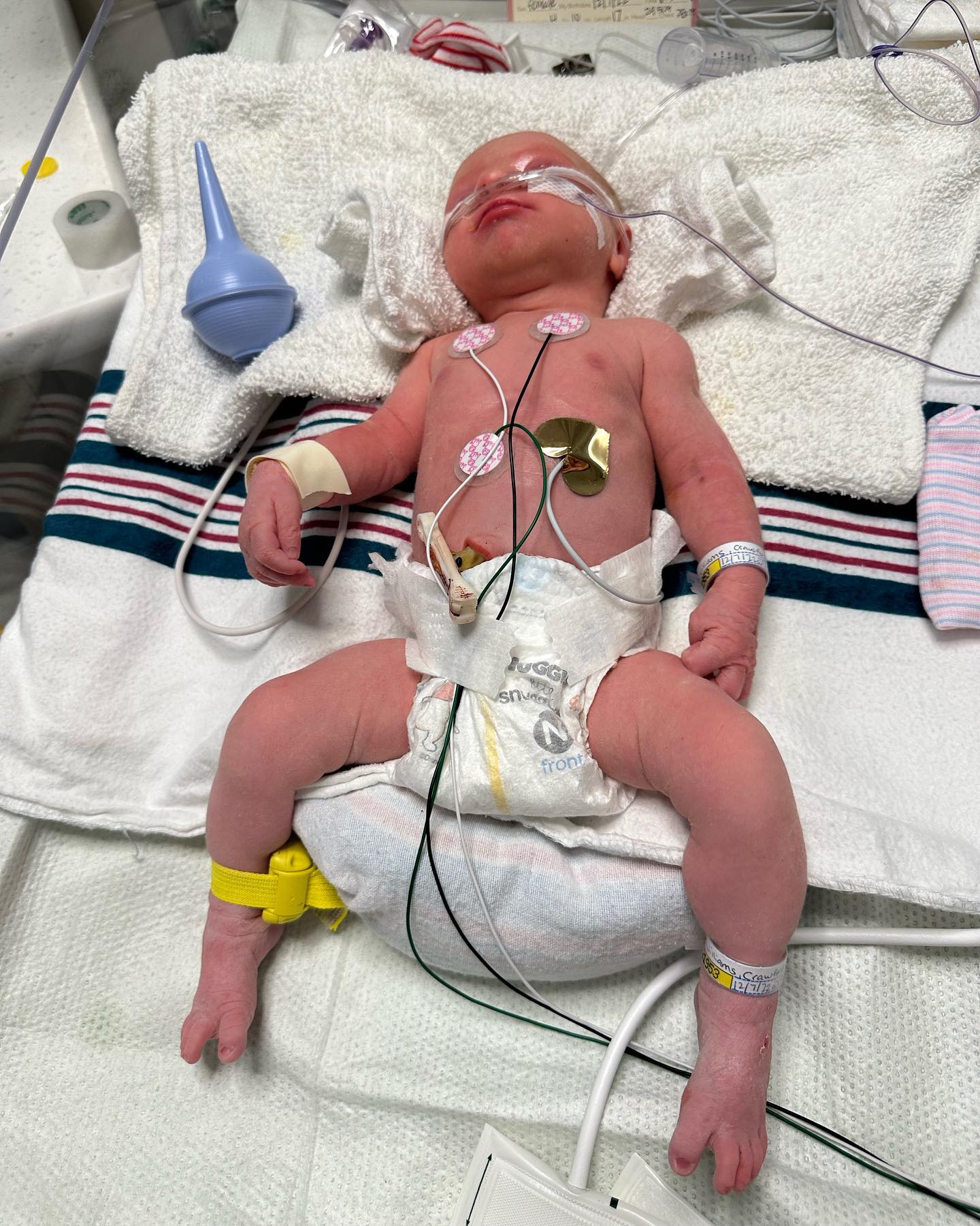 Baby born with super rare condition that only 400 people in world have ...
