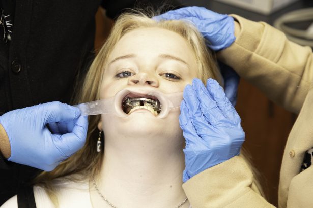 Teen undergoes ‘groundbreaking’ surgery to restore smile after smashing ...