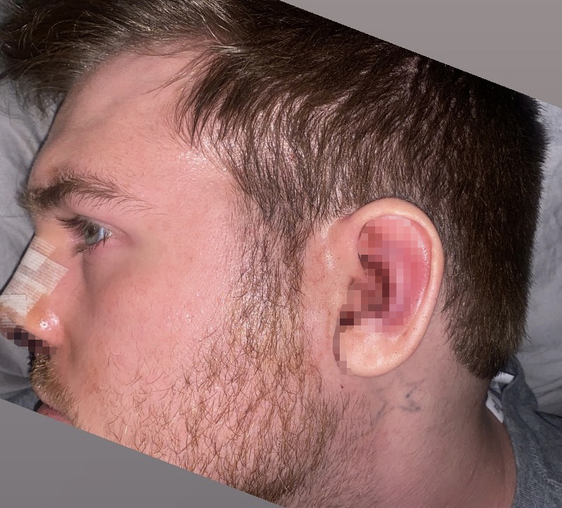 ‘My life has turned into absolute hell after BOTCHED surgery left me ...