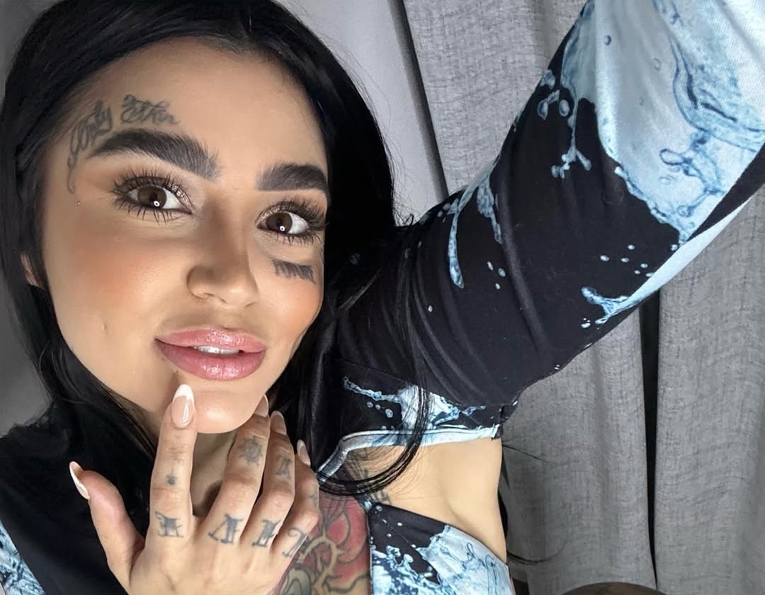 Model dies on honeymoon to Turkey after ‘accepting free lipo surgery ...