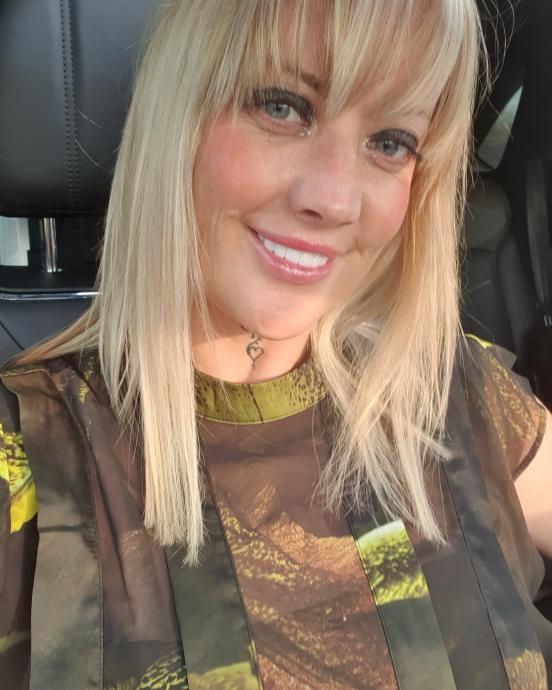 Mum’s ‘face collapsed’ after botched dental implants in Turkey | Need ...