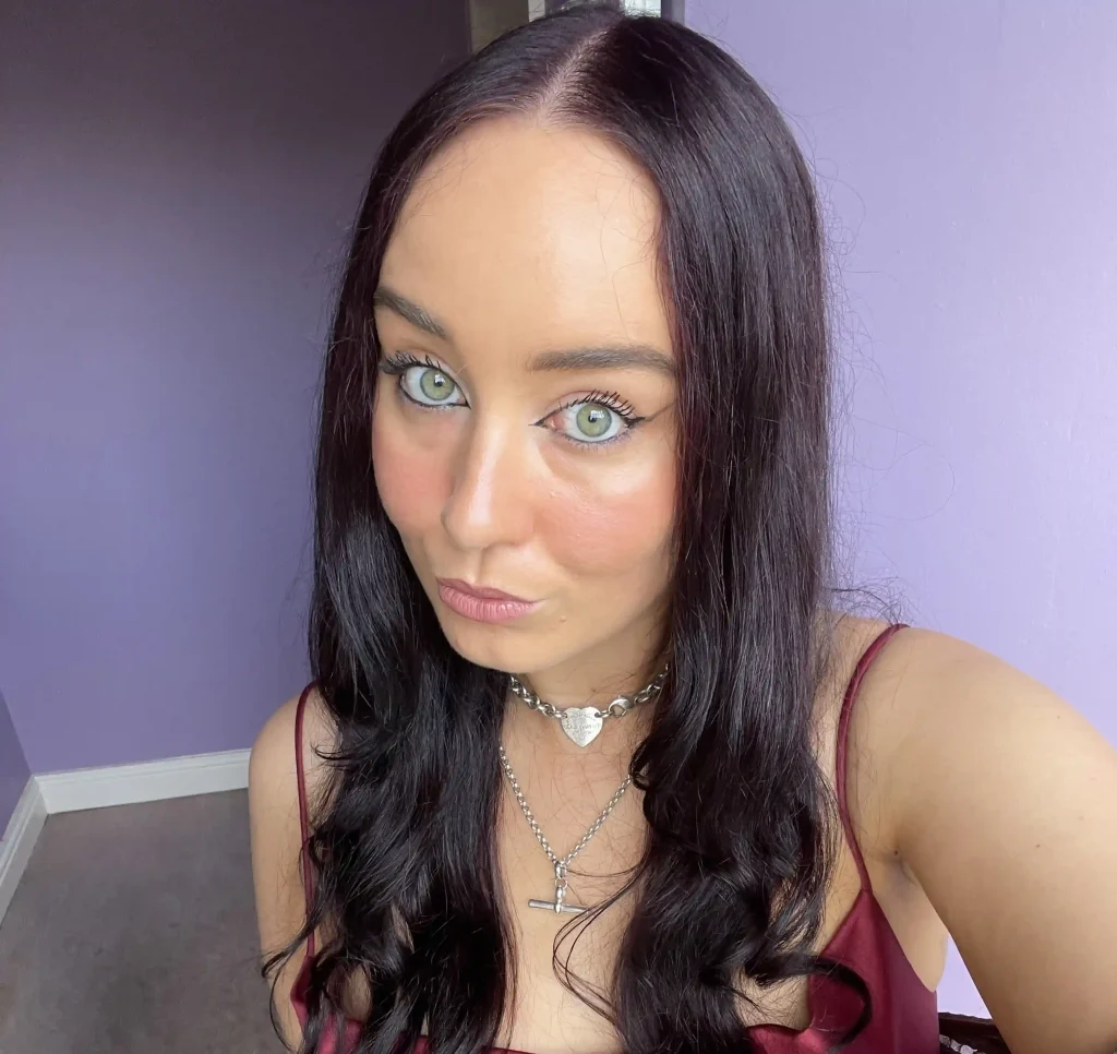 Woman bitten by ‘Britain’s most dangerous spider' in pub left with ...
