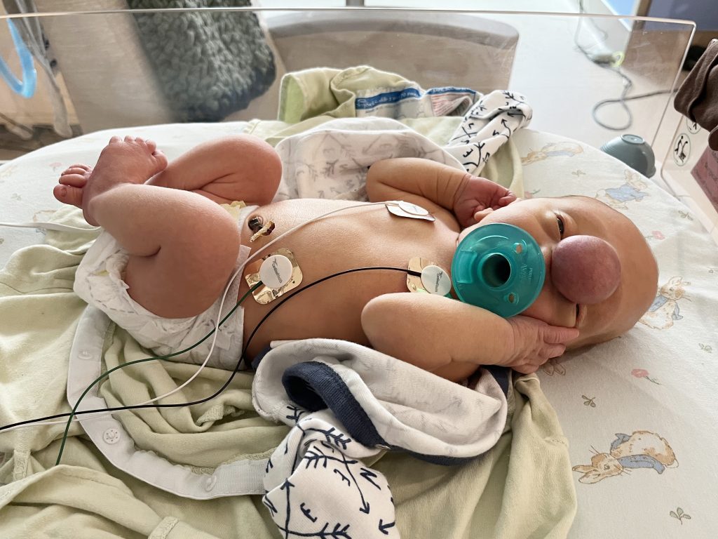 ‘My baby was born with a bubble on his forehead and had to fight for ...