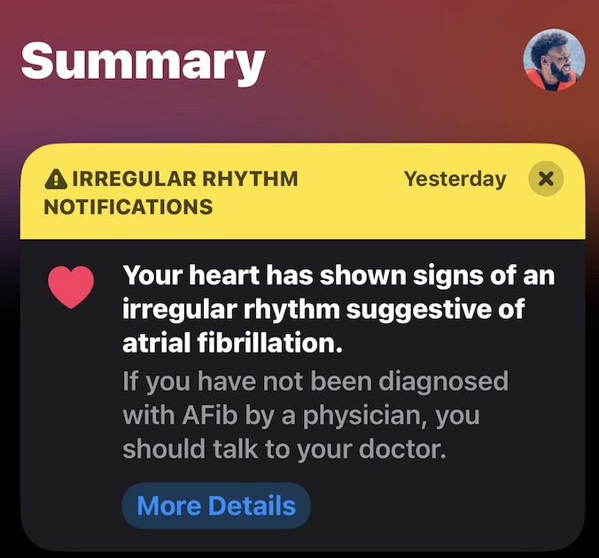 'I rushed to hospital when my Apple Watch sent warning signs of a heart ...
