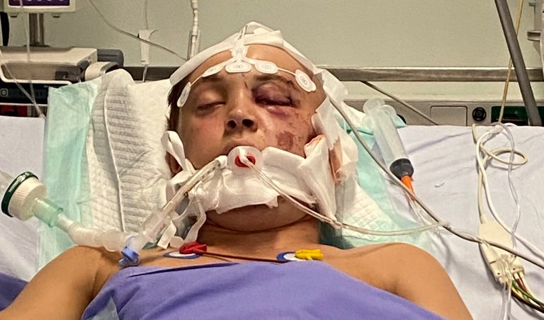 Mum begs for help after son suffers brain bleed in holiday horror ...